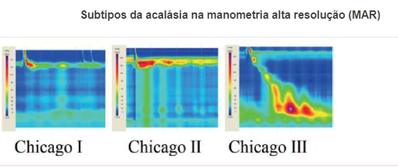 Manometria Esofágica • Nuvem Medicina