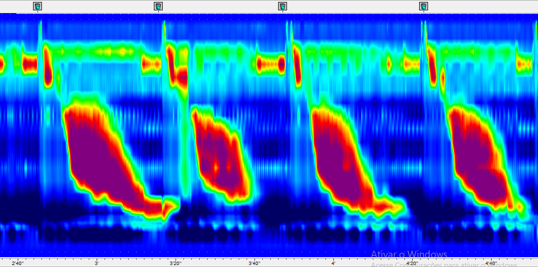 Manometria Esofágica • Nuvem Medicina
