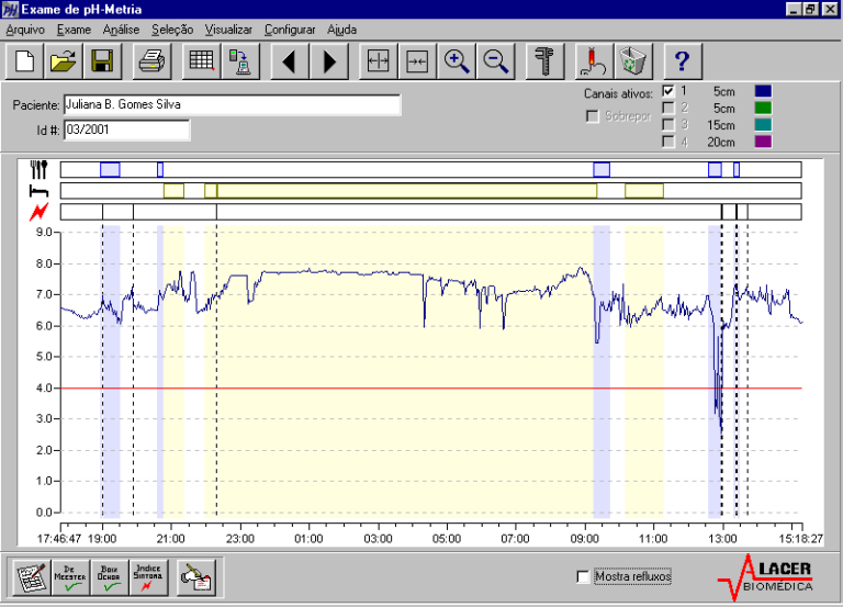 PHmetria Esofágicas • Nuvem Medicina