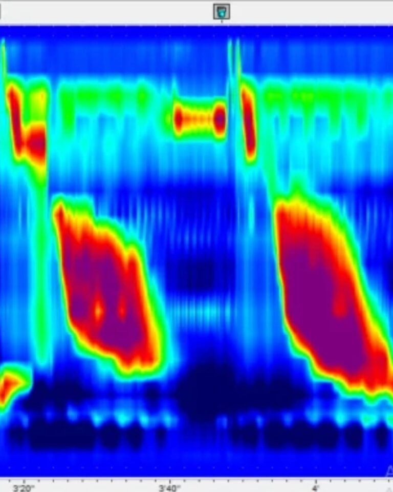 Manometria Esofágica • Nuvem Medicina